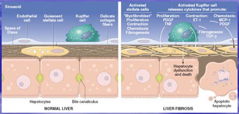 Lec Liver Flashcards Quizlet