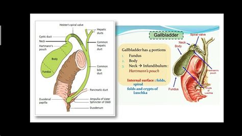 Cholecystitis Youtube