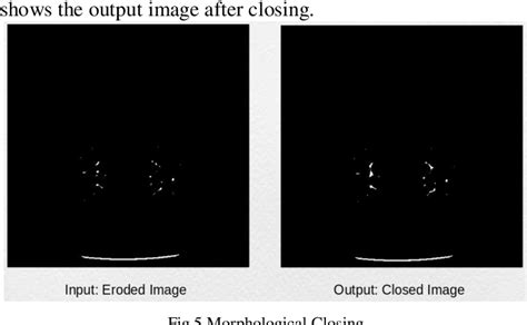 Figure 5 From Lung Nodule Detection And Classification Using Machine Learning Techniques