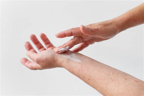 Adhesive Allergy The 411 You Must Know