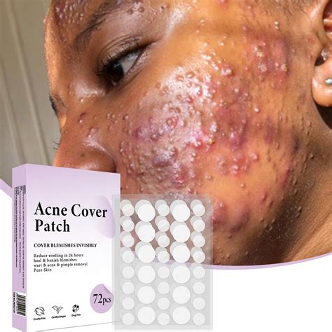 pimple patches for face pimple patches 3 size round covers