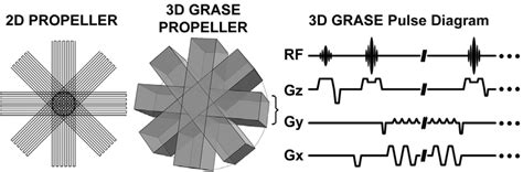 A The Schematic Illustration Of K Space Trajectory For 2d Propeller Download Scientific
