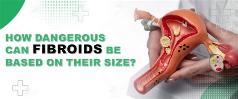 Heavy Bleeding And Fibroid Tumors Fibroid Uterine Fibroids Are A