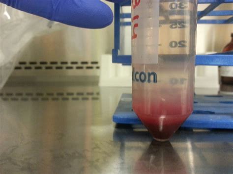 198 Questions With Answers In Pbmc Isolation Science Topic