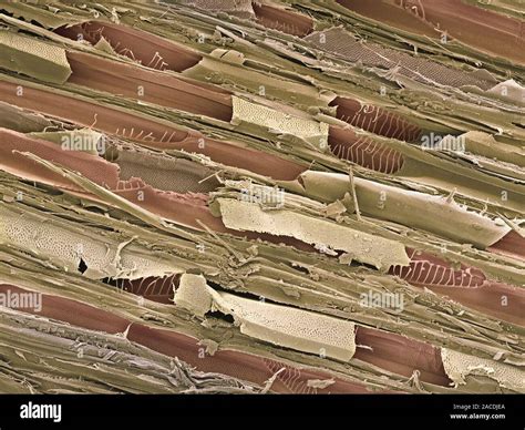 Xylem Plant Cells Coloured Scanning Electron Micrograph Sem Of A