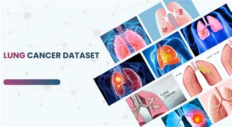 Lung Cancer Dataset For Early Detection Ai Driven Health Solution