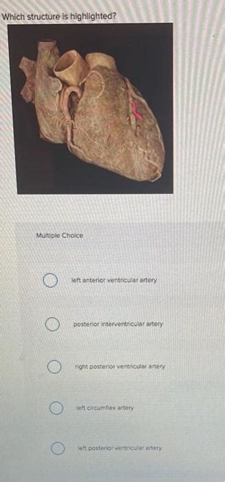 [solved] which structure is highlighted multiple choice o