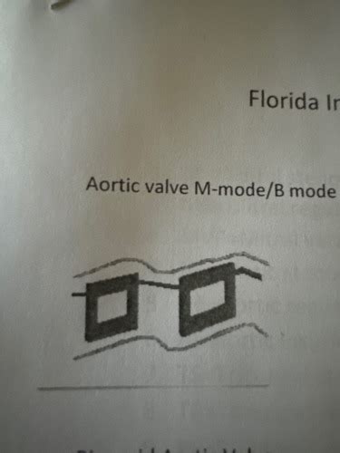 Echo Quiz Flashcards Quizlet Echo Quiz Flashcards Quizlet