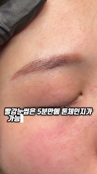 빨강눈썹 해결하는 방법 카카오채널 뮤즈비비 부산눈썹문신 동안되는법 반영구해결사 동안시술 메이크업 アートメイク Youtube