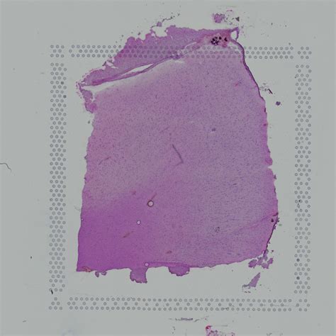 GitHub LieberInstitute SpatialLIBD Code For The SpatialLIBD R