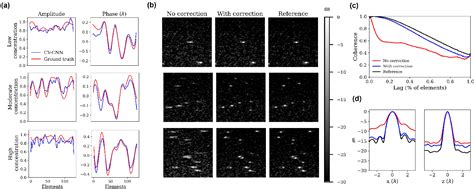 Phase Aberration Correction For In Vivo Ultrasound Localization