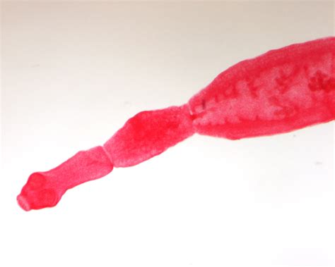 Creepy Dreadful Wonderful Parasites Answer To Case 175