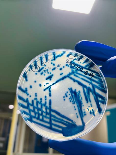 E Coli On Cca Agar Chromogenic Coliform Agar Typically Shows… Nitesh Patil