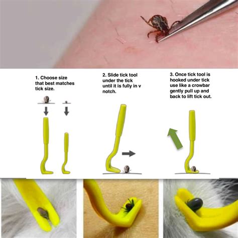 Tick Removal Tool How To Use
