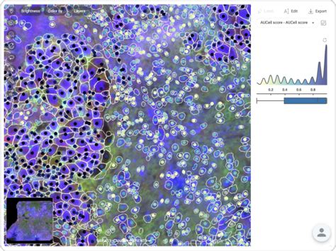 BioTuring Lens Spatial Omics Analytics Platform