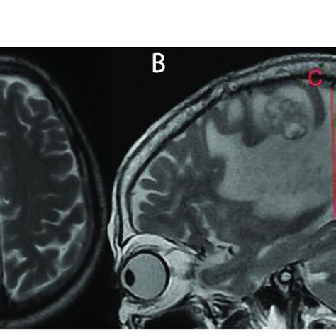 Demonstration Of Volume Calculation Technology Volume Calculation