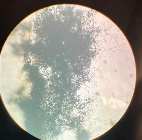 Solved Identify The Genus Of The Following Fungus Describe