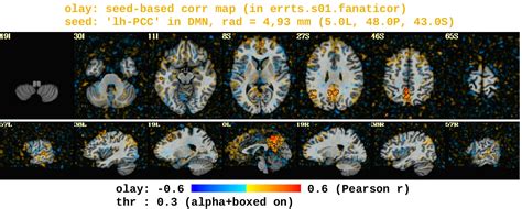 Afni Proc Py Example 11b Afni Message Board Afni Discuss Message Board