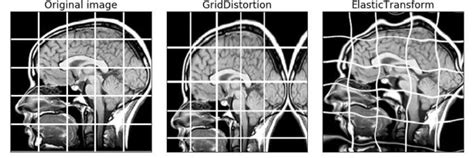 The Ultimate Guide To Nnu Net For State Of The Art Image Segmentation