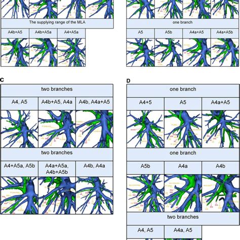 3d Reconstruction Model Of The Branches Of The Lingular Segment Artery