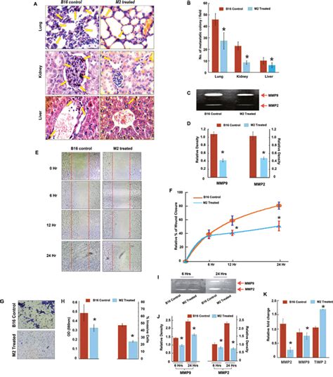 Lincrna00273 Promotes Cancer Metastasis And Its G Quadruplex Promoter Can Serve As A Novel