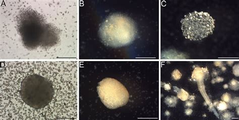 Microspore Derived Structures Observed In DH36 Microspore Cultures With Download Scientific