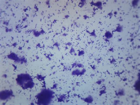 Bacteria Under Microscope