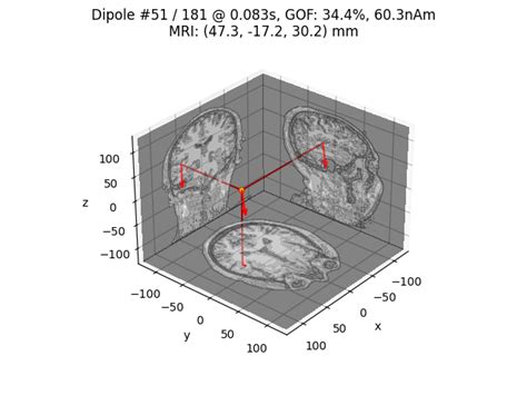 compute sparse inverse solution with mixed norm mxne and irmxne — mne 0 23 4 documentation