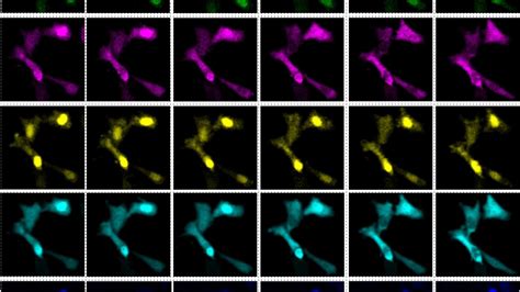 This New Cellular Imaging Technique Could Unlock Cancer