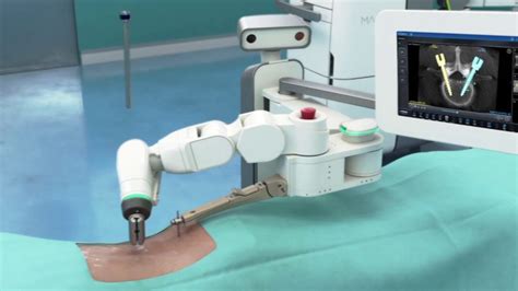 Mazor X Stealth Robot Assisted Spinal Surgery Launches In Us