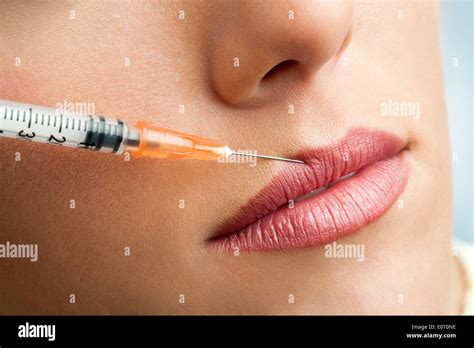 Botox Injections Lips