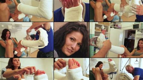 Emma Term Slwc Gets Casted Long Toes In Term Casts