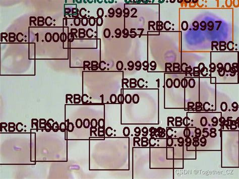 服务医学，基于目标检测模型实现细胞检测识别 医学检验目标检测 Csdn博客