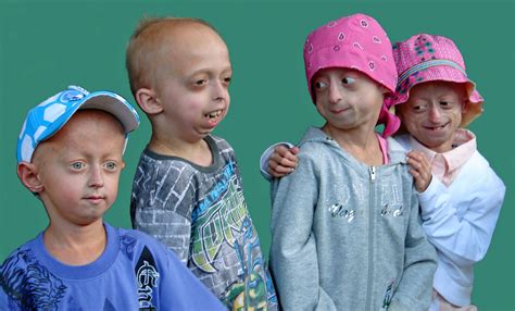 progeria family circle: 08.2010