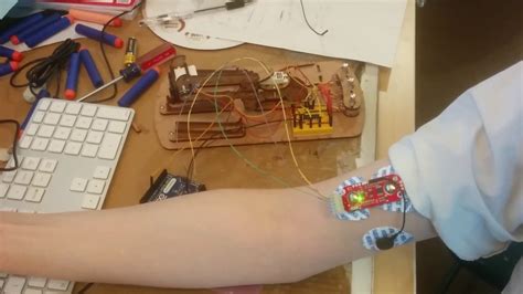 Myoware EMG Sensor Arduino Servo YouTube