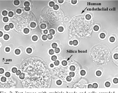 figure 1 from deep learning based semantic segmentation of microscale objects semantic scholar