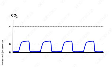 Vector De Stock Capnography Waveform During High Quality Cpr Adobe Stock