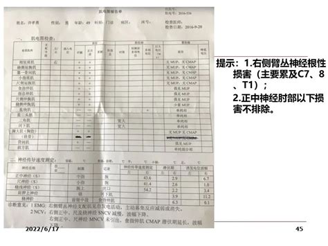 超详细的臂丛神经秘籍，建议收藏！ 德医医学 助力医学教育发展！