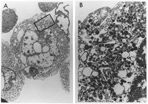 Figurie 2 An Electron Micrograph Of Megakaryocytes From A Preparation Download Scientific