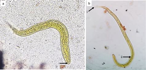 A S Stercoralis L1 Rhabditiform Larva Seen In The Fecal Wet Smear The