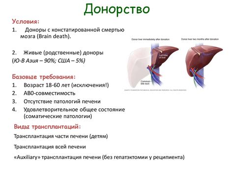Трансплантация печени Послеоперационные осложнения Клинический случай презентация онлайн