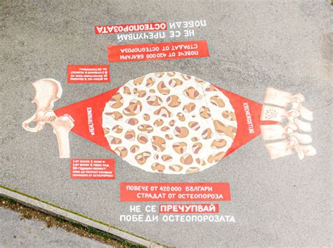 Д р Наталия Темелкова Менопаузата ключов момента за начало на остеопороза Здраве БНР Новини