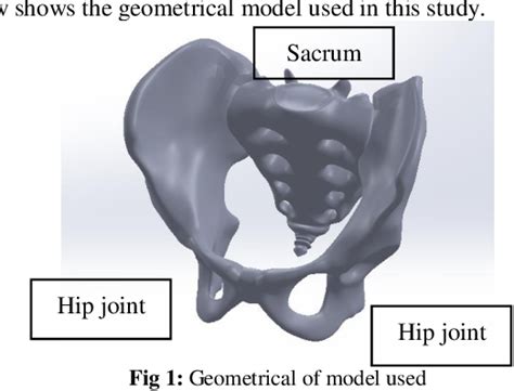 Figure 1 From Finite Element Analysis On Pelvis With Leg Length Inequality Semantic Scholar