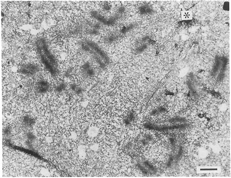 Sister Chromatids Separate But Fail To Segregate In Anticenp C Injected