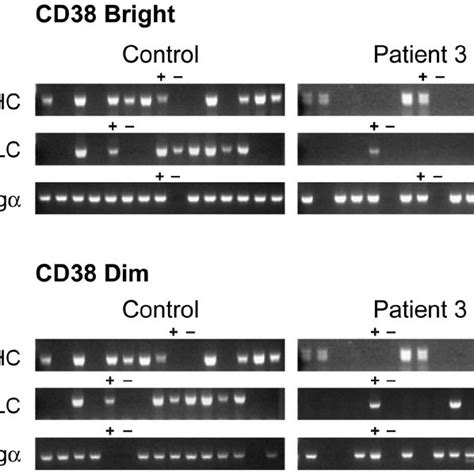 Expression Of B Cell Markers On Bm Derived Cells Download Table