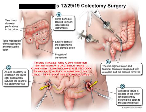 Medical Exhibits Demonstrative Aids Illustrations And Models