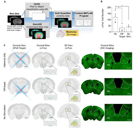 Figure 1 From Transcranial Focused Ultrasound Stimulation With High