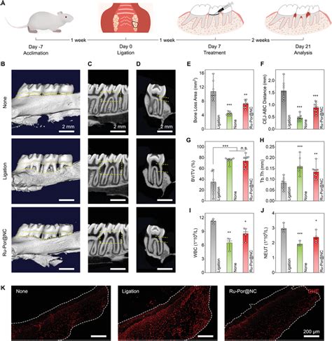Periodontitis Treatment Assessment Of Ru‐por‐net‐based Antioxidase‐like Download Scientific