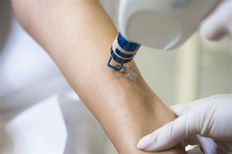 Scar Treatment In Hutchinson Mn Hutchinson Laser And Aesthetic