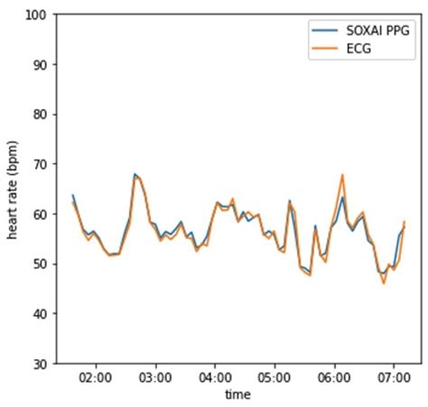 Soxai Inc ソクサイ On Twitter 🫀心拍数測定に関する現在地報告app 120 Fw 012 センサーの信号処理を改善したことで、より正確な心拍数を表示
